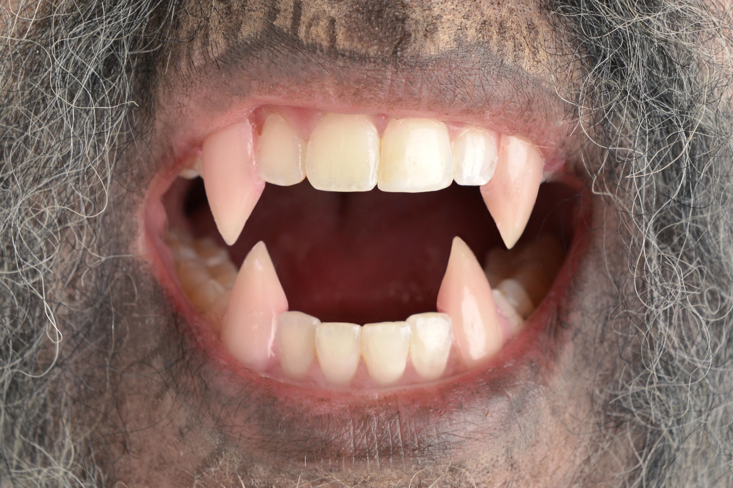 Custom Designer Halloween Werewolf Fangs | Party City